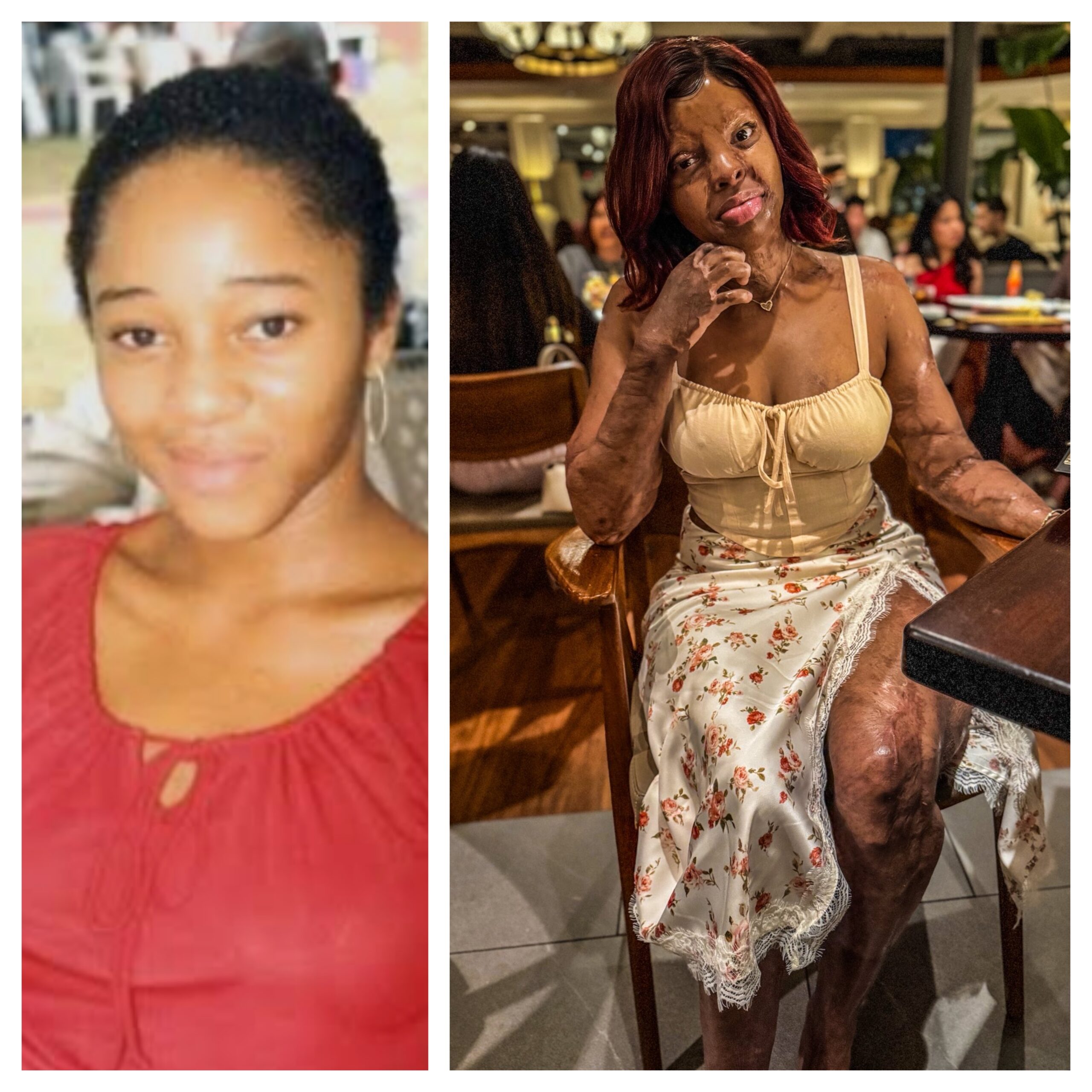 Sosoliso Plane Crash Survivor Kechi Okwuchi Expressed Gratitude For Her ...